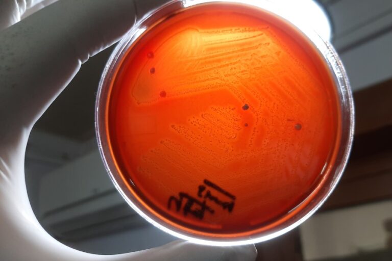 Alerta por casos de Streptococcus pyogenes: una enfermedad invasiva que ...